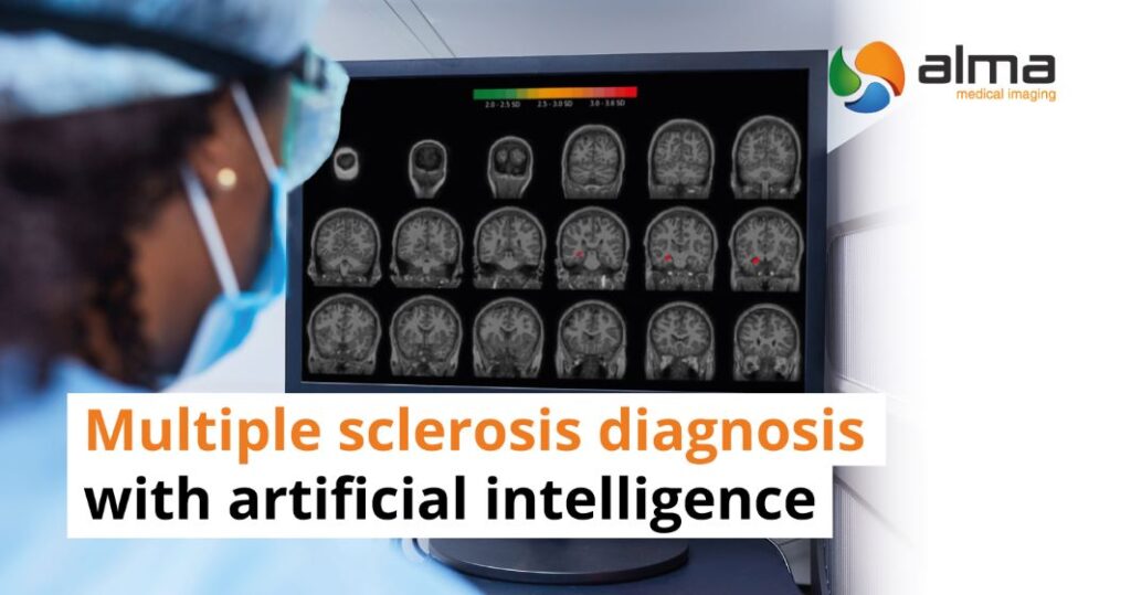Diagnosing multiple sclerosis with artificial intelligence